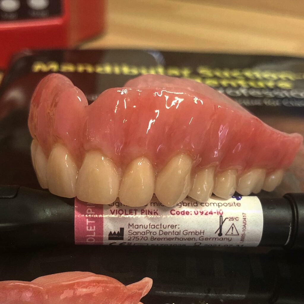 Removable Prosthetics - CD Dental Lab
